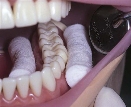 Operative Dentistry | INBDE Booster